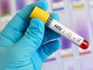 Identifying Signs of HIV/AIDS - Brevard Health Alliance
