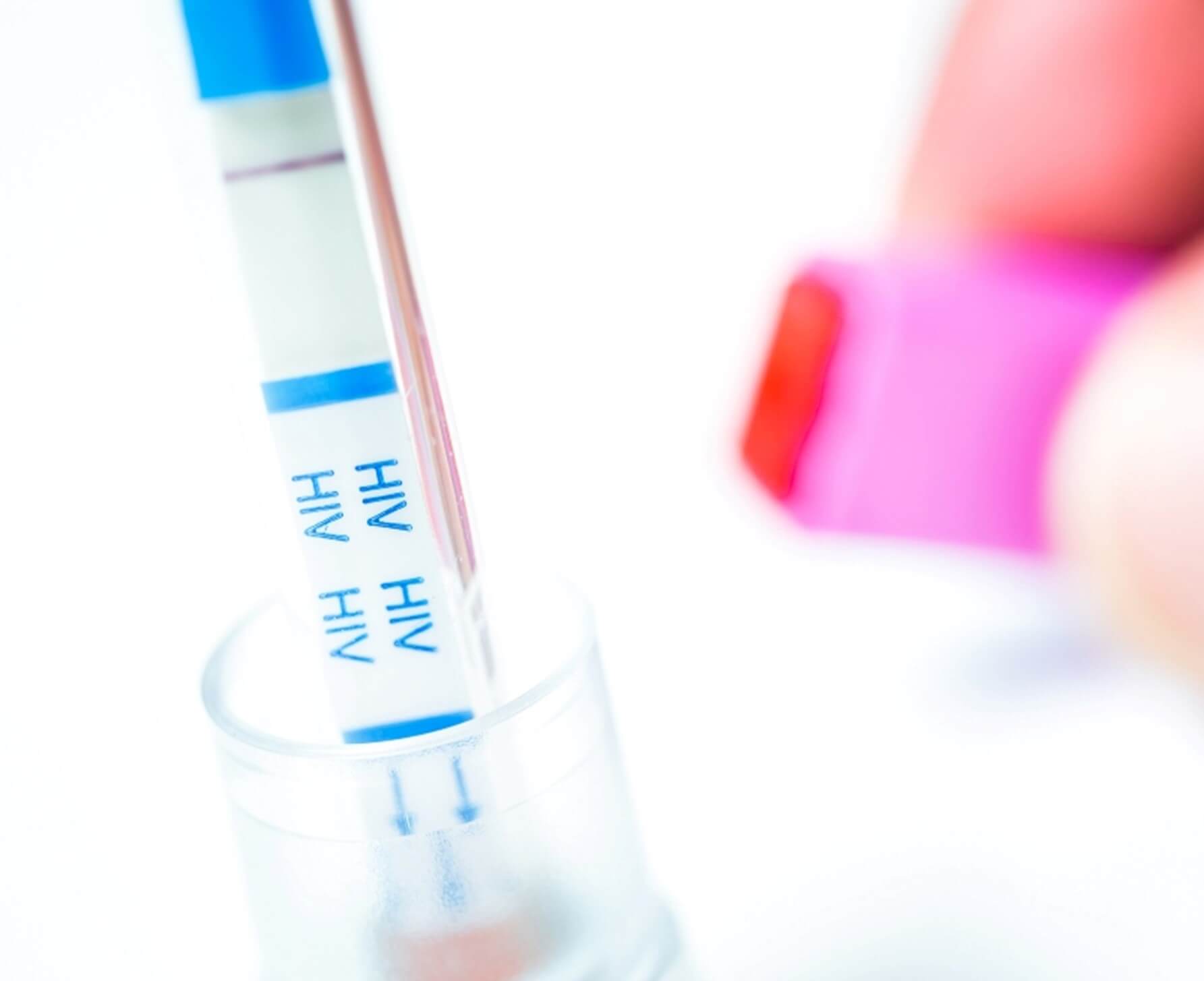 Understanding the Functionality of HIV Test Kits