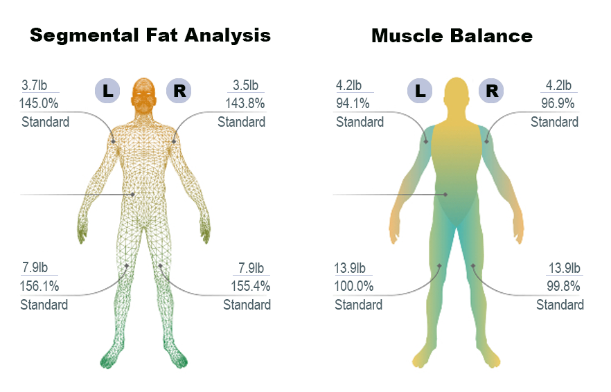 Focus on Body Composition for Better Health